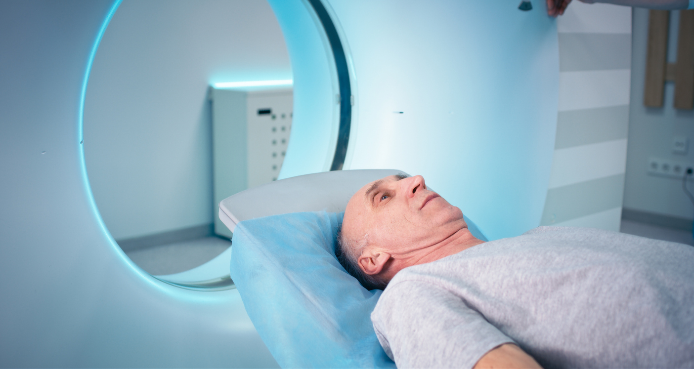 Hypofractionated proton beam therapy regimen feasible for glioblastoma ...